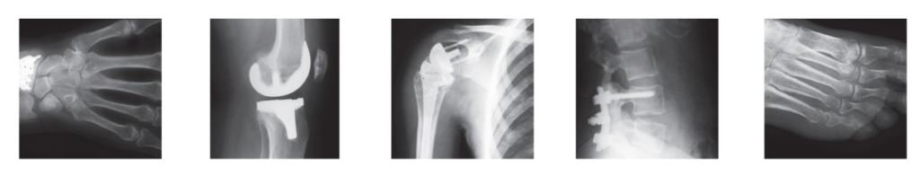 Orthopedic Imaging - Georgia